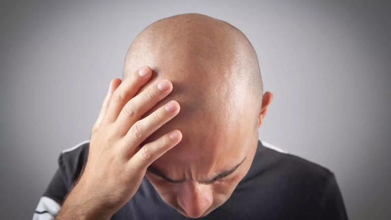 5 things you do every day that are making you lose hair faster