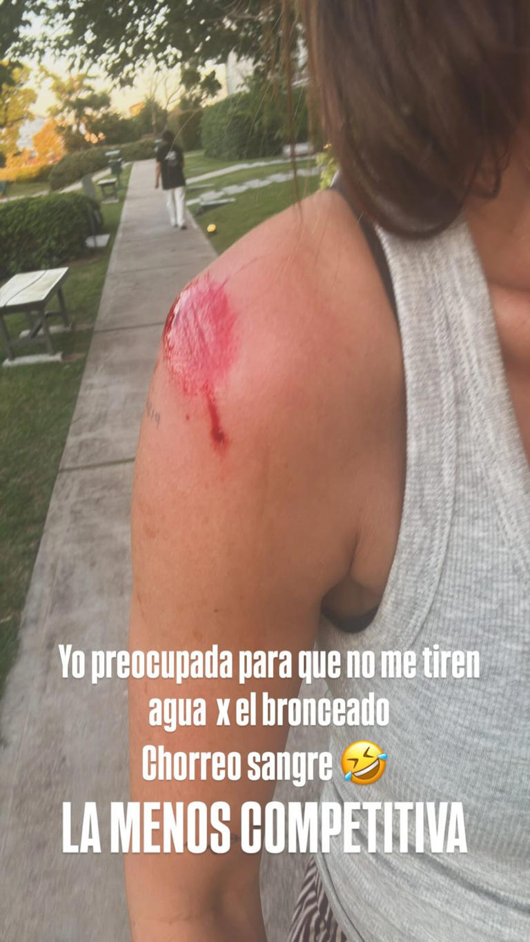 Paula Chaves exhibió las impresionantes heridas que se hizo mientras ...