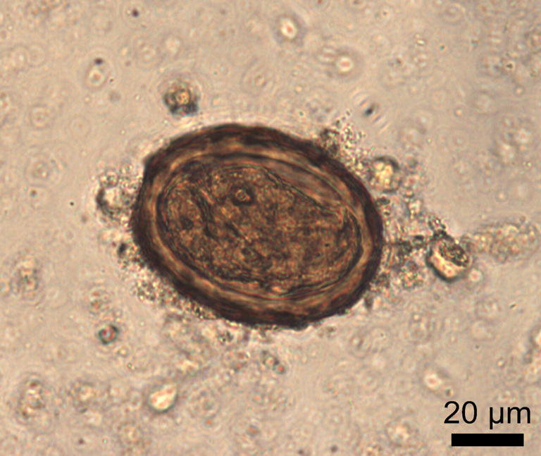 Roman soldiers defending Hadrian's Wall were infected by parasites ...