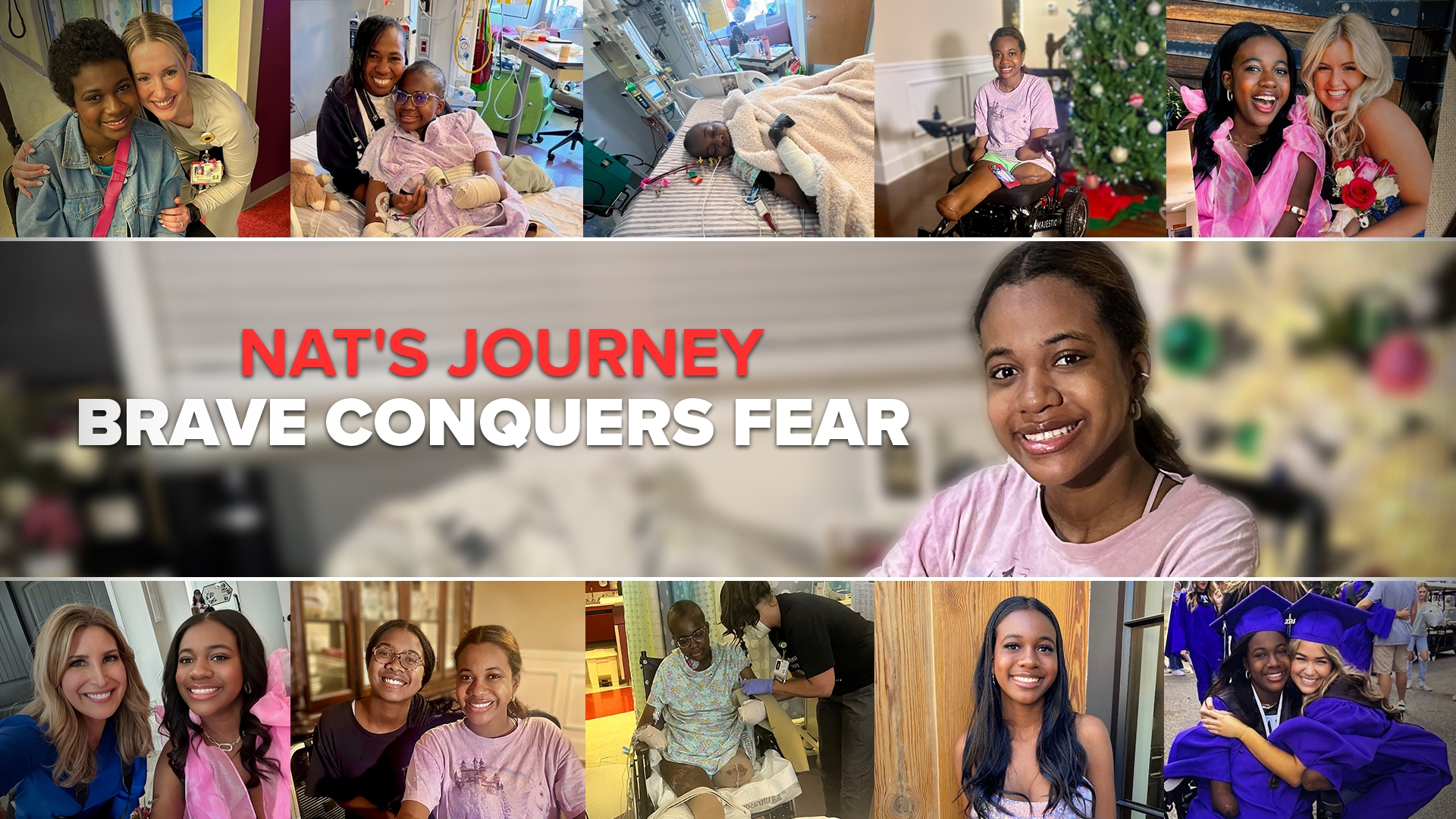 Georgia teen survives sepsis and four amputations | Brave conquers fear