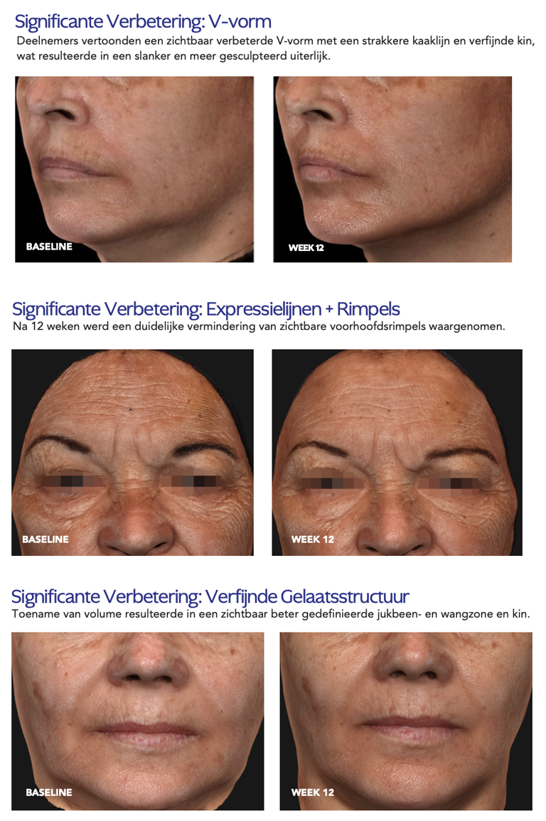 Waarom dit nieuwe peptide-serum een gamechanger is, volgens een ...
