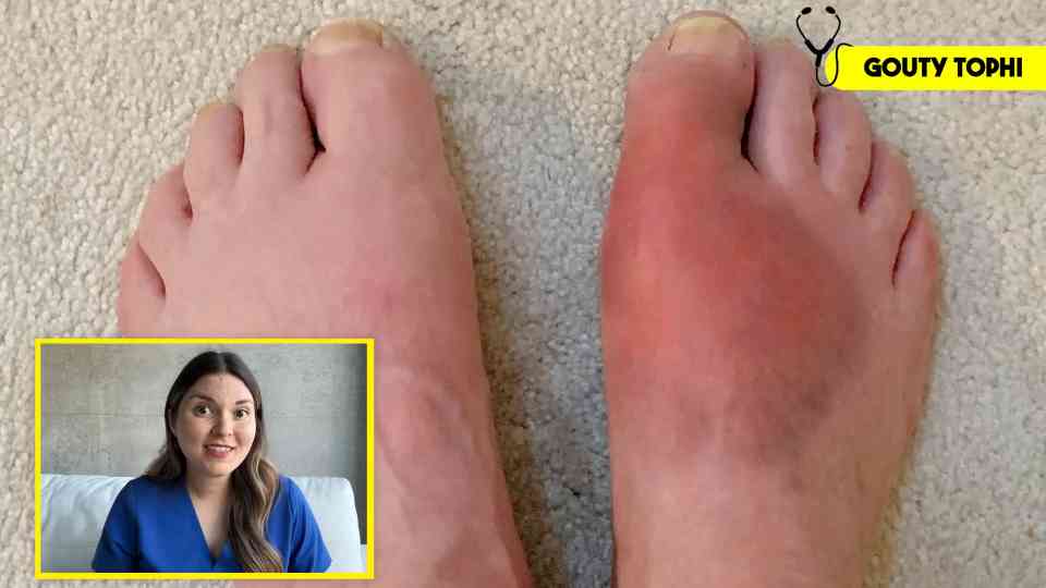 The hidden health signs in your knees