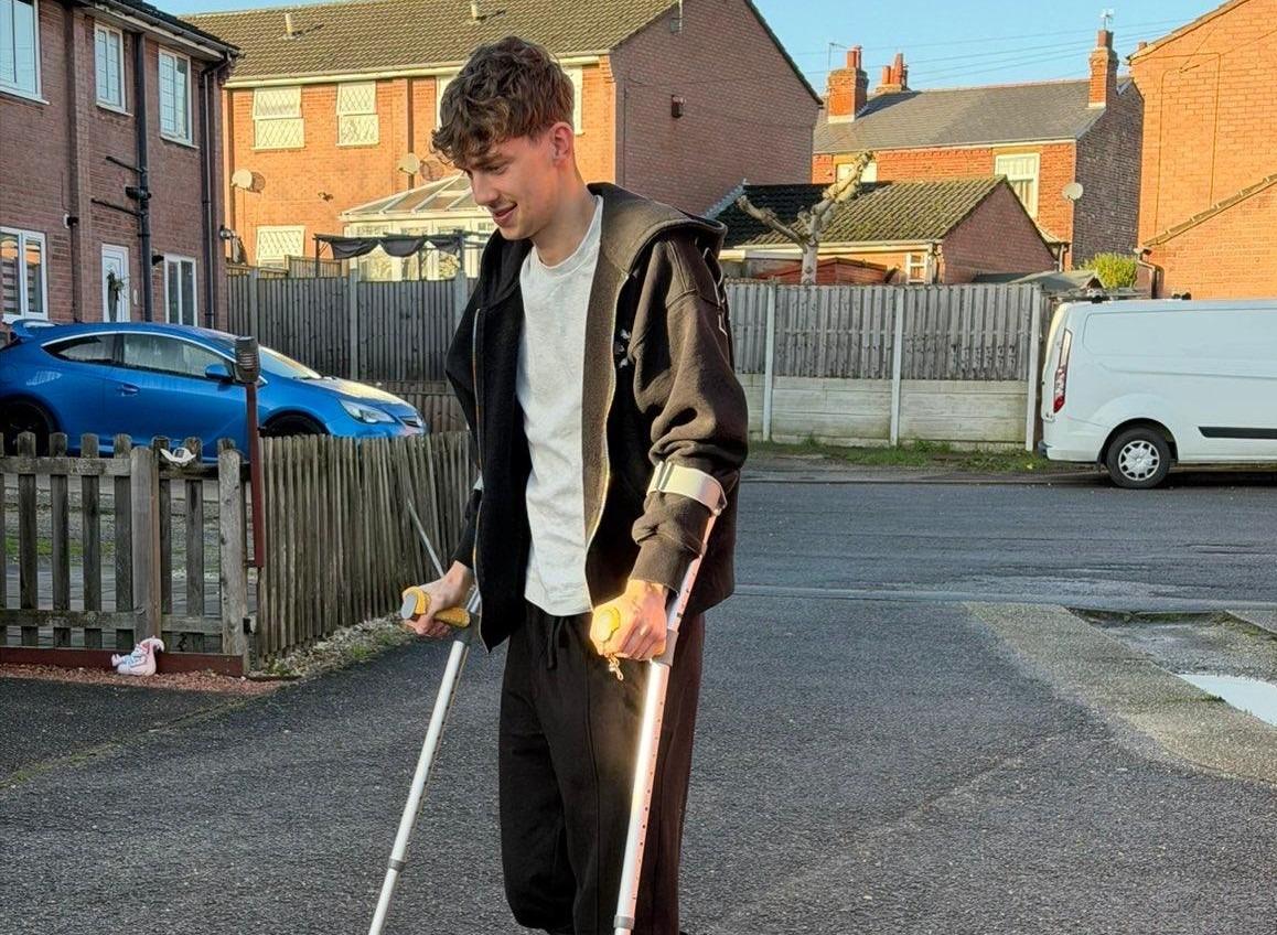 Chesterfield footballer fractured leg and ankle falling over fence ...