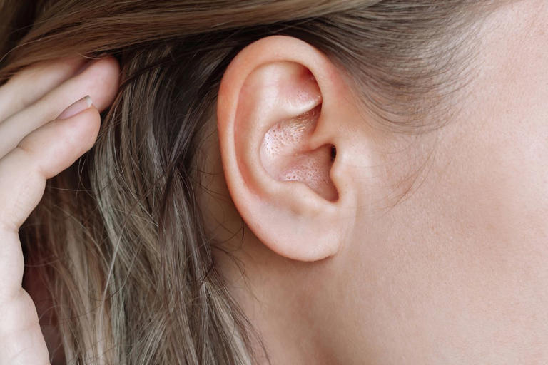 Pimples in your ear, causes, and how to treat them