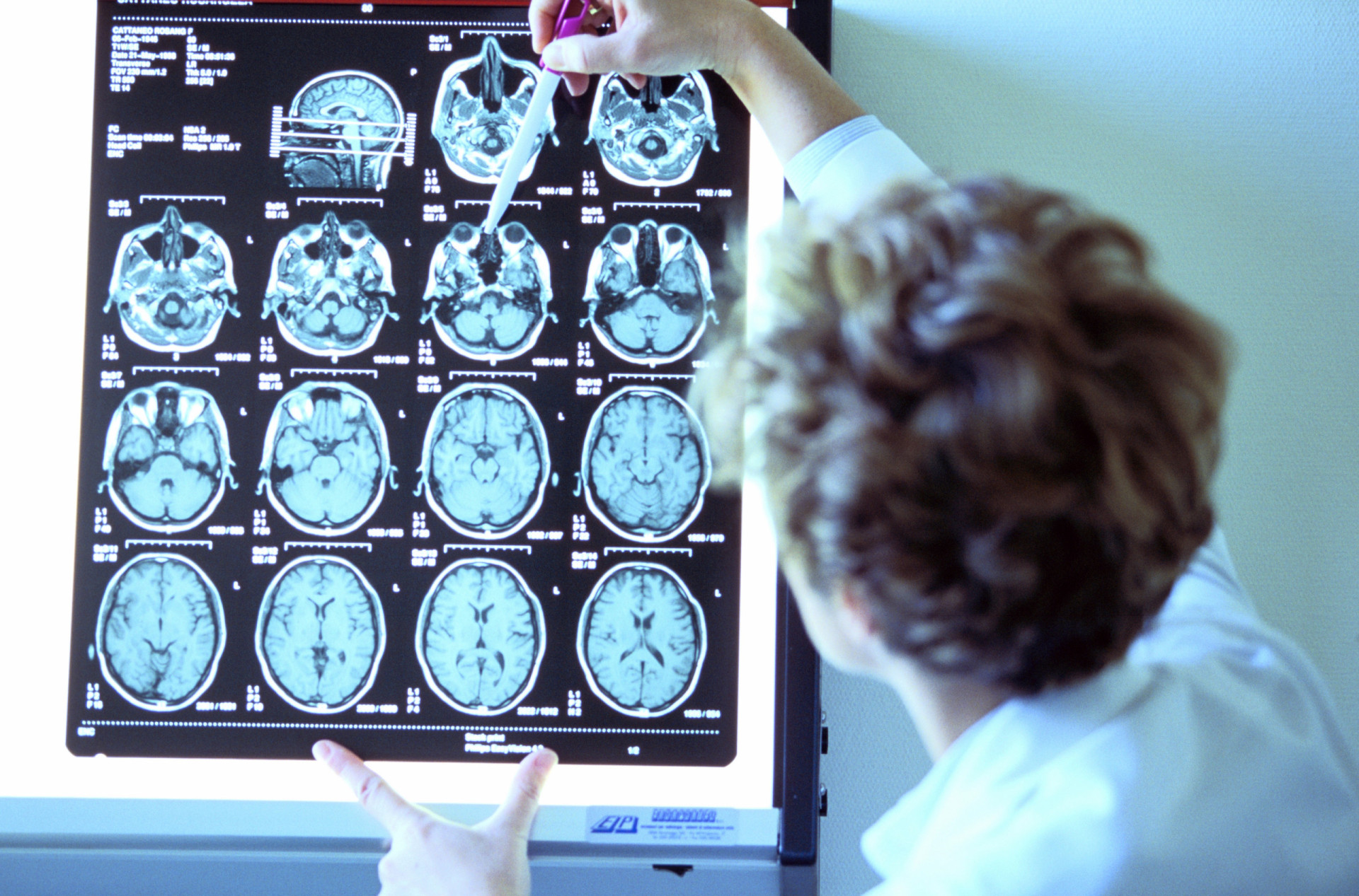 Science explains that weird déjà vu feeling