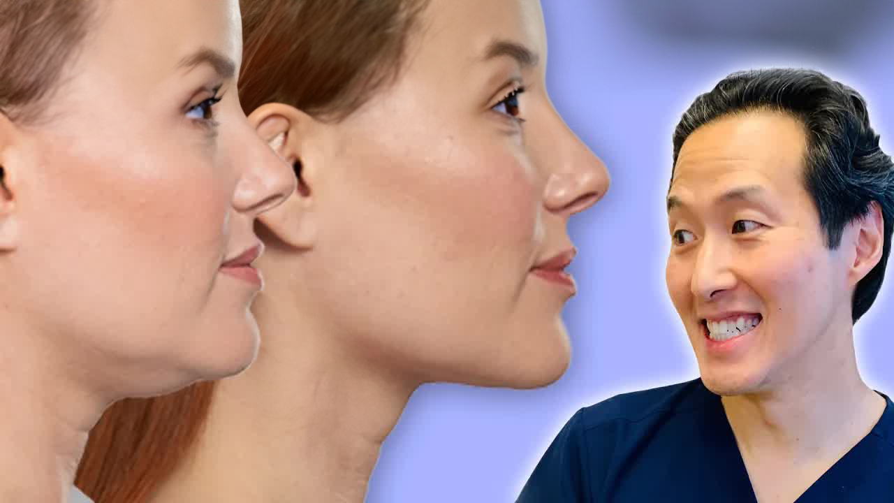 Non-surgical techniques to rejuvenate the neck