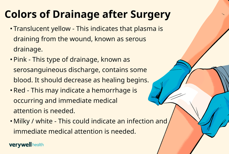 Serosanguineous drainage and wound healing
