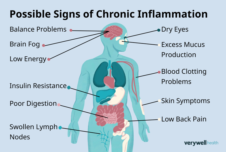 11 chronic inflammation symptoms