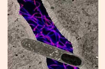 Discover the gut bacterium that could revolutionize weight loss!