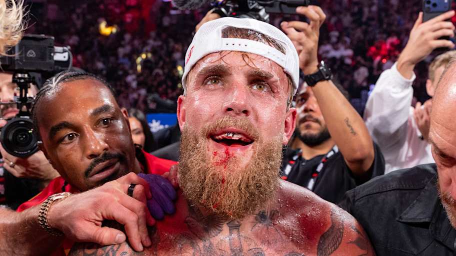 Jake Paul shares gruesome surgery update after Anthony Joshua knockout