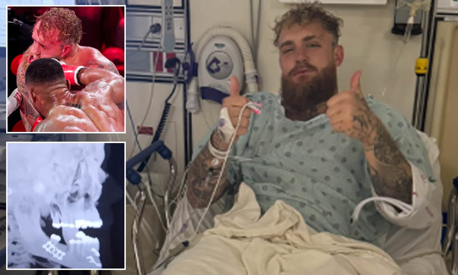 Jake Paul issues health update from hospital bed after having jaw ...