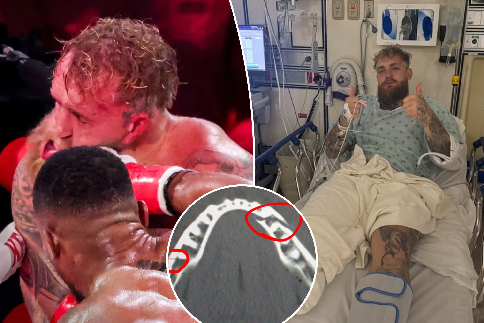 Jake Paul reveals jarring extent of jaw injury after post-fight surgery