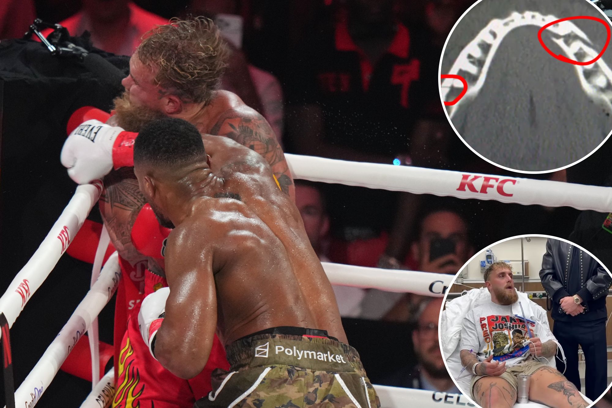 Jake Paul suffered broken jaw while being knocked out by Anthony Joshua ...