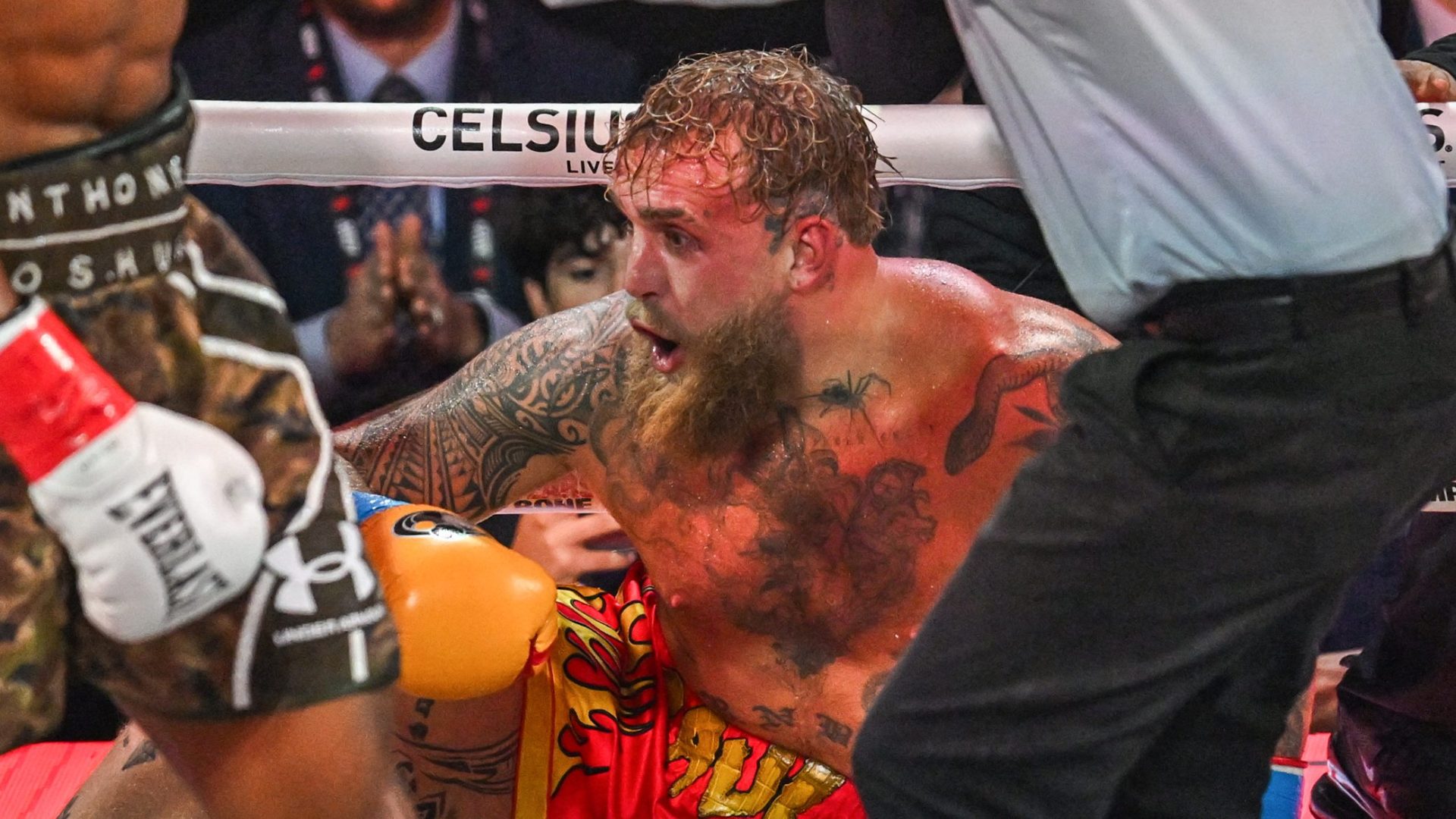 Jake Paul posts X-ray showing brutal injury after KO loss to Anthony Joshua