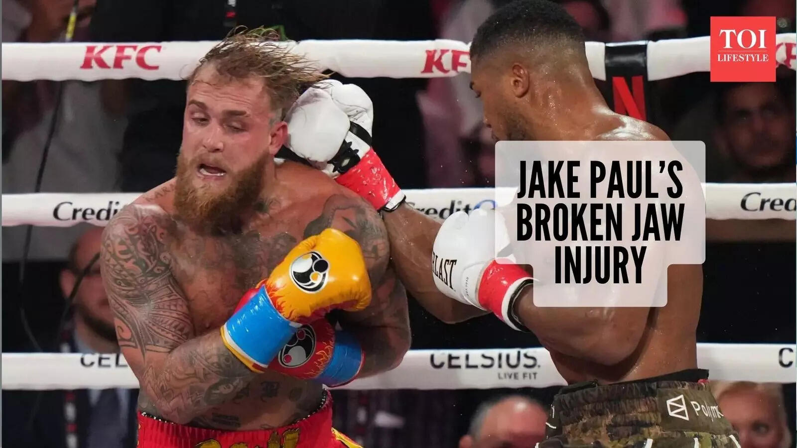 Jake Paul confirms double broken jaw after loss to Anthony Joshua: What ...