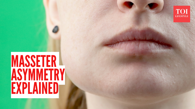 Masseter asymmetry explained: How chewing habits can subtly reshape ...