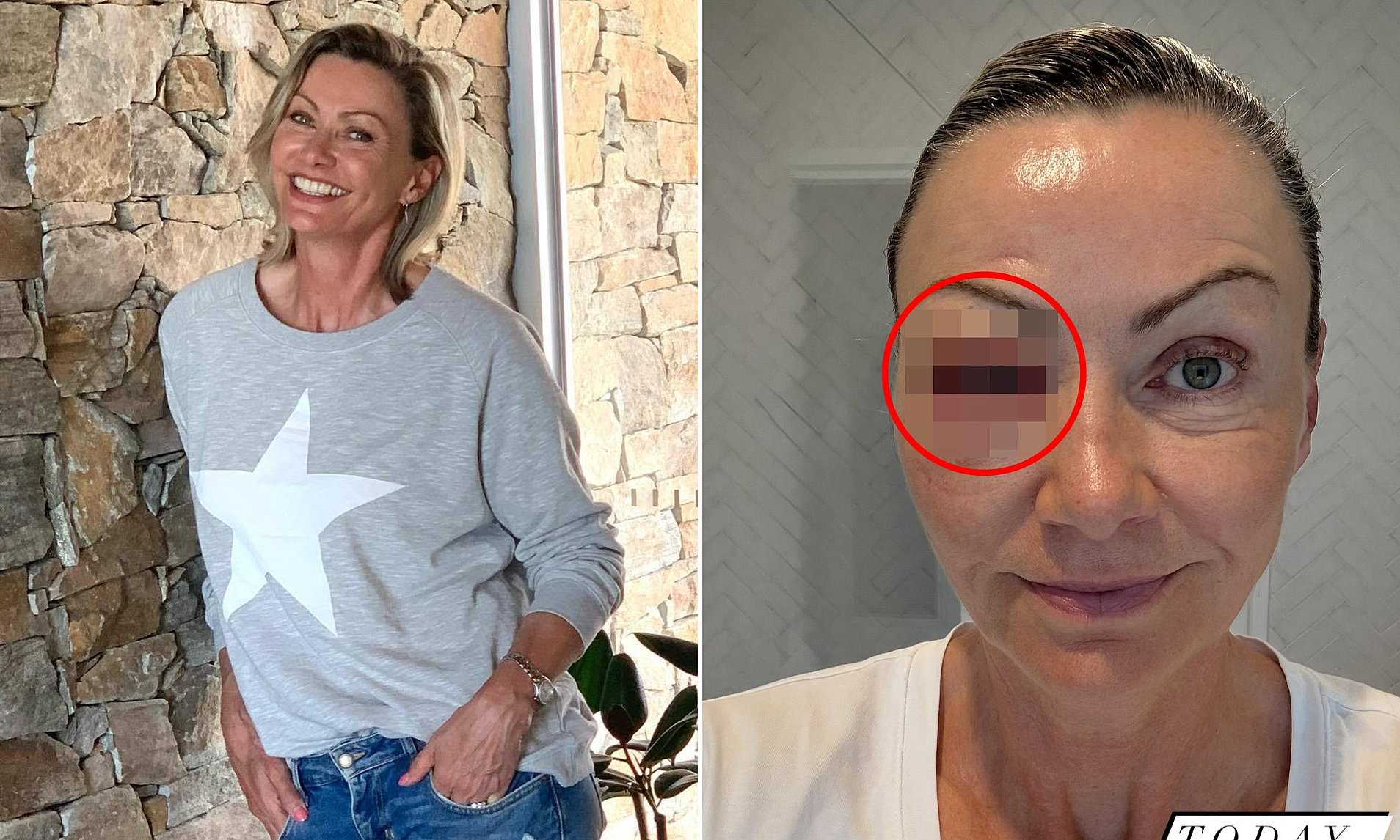 Nicky Buckley shocks fans with graphic eye surgery photos