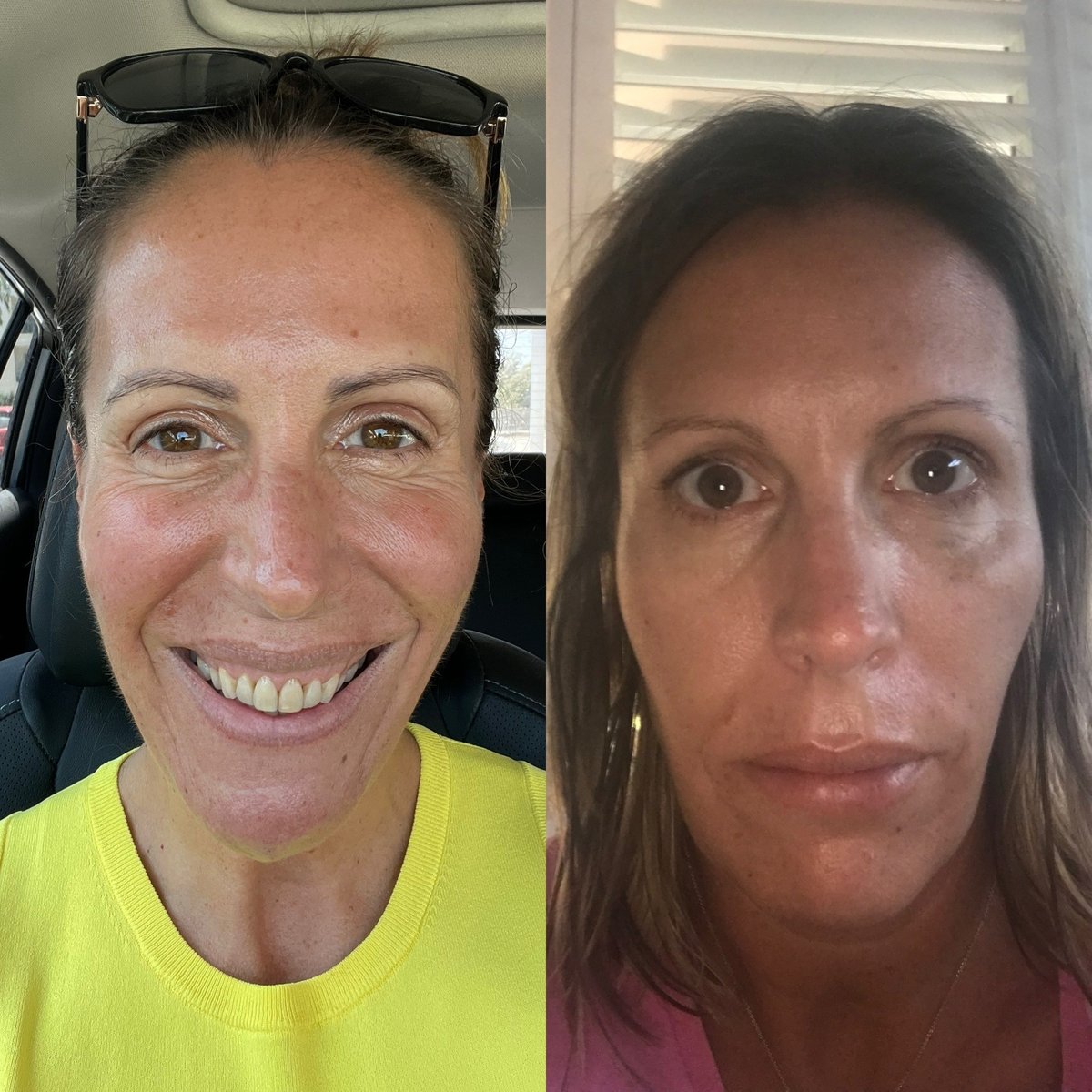 I wasn't at rock bottom, but on Christmas morning, "grey area drinking ...