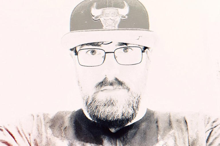 Man with 'world's tiniest micropenis' admits 'embarrassing' difficulty ...