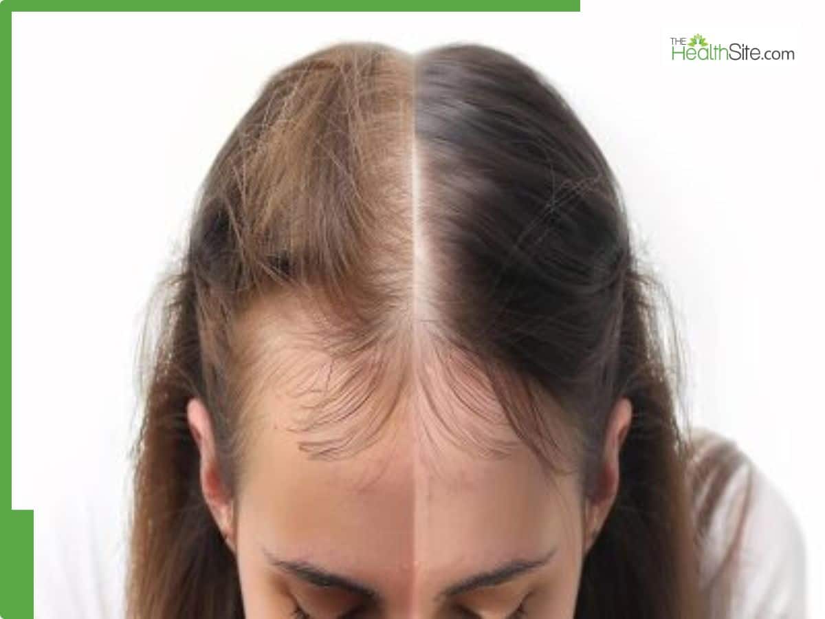 Hot oil massage vs cold oil massage: Which one works better for new ...