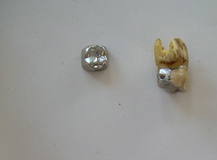 20 interesting finds people made with metal detectors