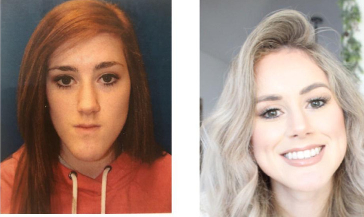 14 people who changed so drastically, they’re hardly recognizable