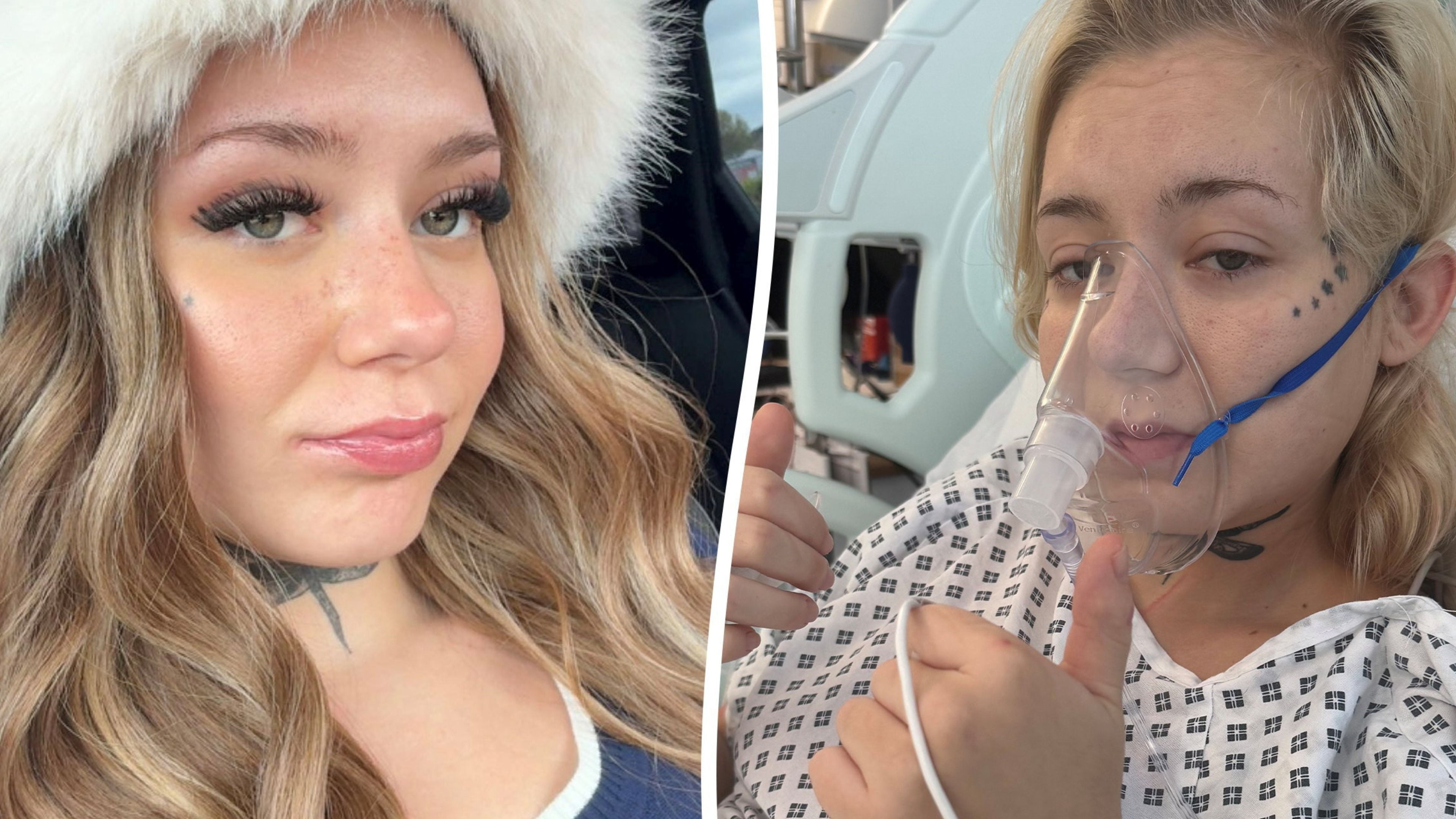 Vaping woman, 21, has part of lung removed after getting cancer