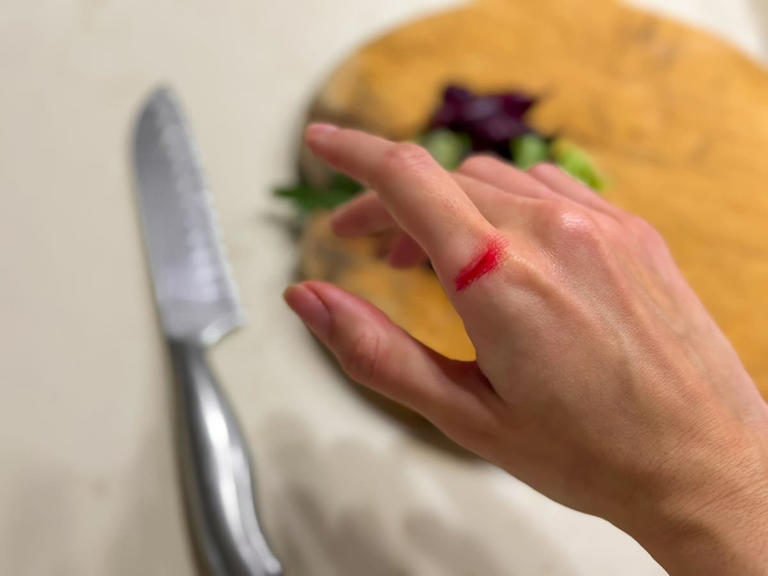 The most common holiday injuries at Main Line Health