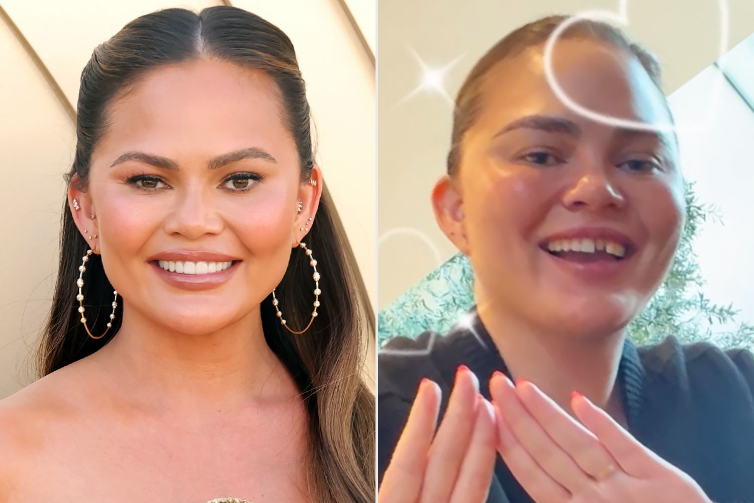 Chrissy Teigen knocks out dental veneer in candy cane game mishap: 'I ...