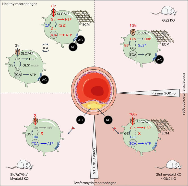 Immune cell 'fuel' shortages shape atherosclerosis, scientists reveal