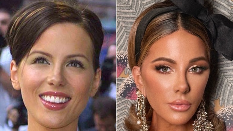 Kate Beckinsale's face transformation has made her nearly unrecognizable