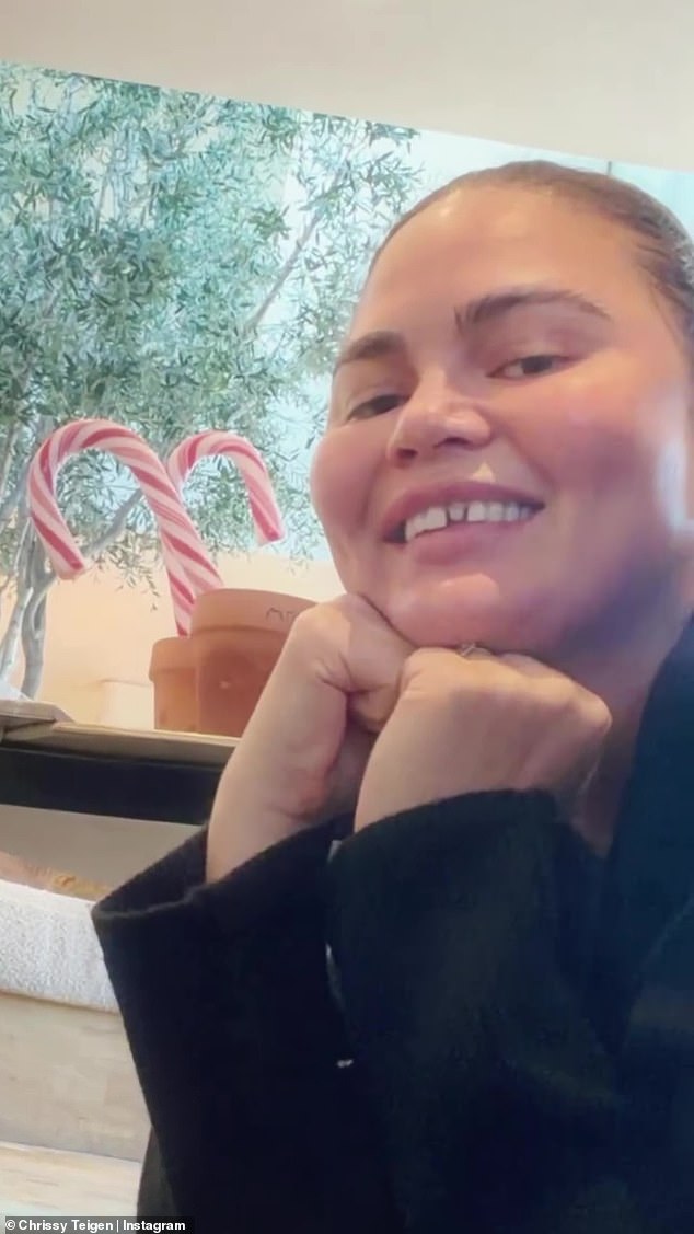 Chrissy Teigen reveals chipped tooth after candy cane game mishap with ...