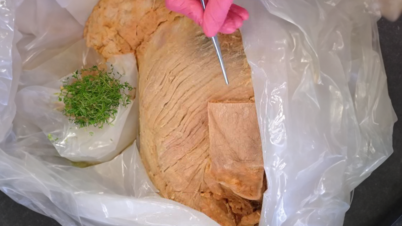 The anatomy of the buttocks