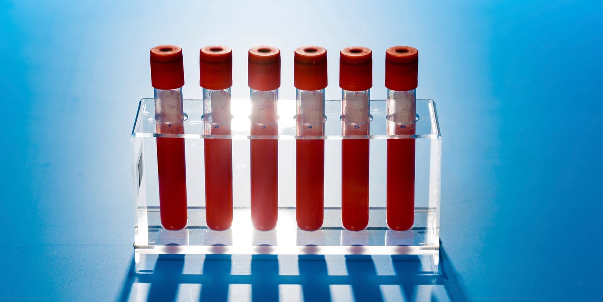 Can a simple blood test predict your osteoporosis risk early?