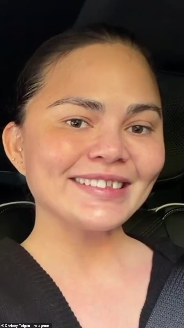 Chrissy Teigen reveals chipped tooth after candy cane game mishap with ...