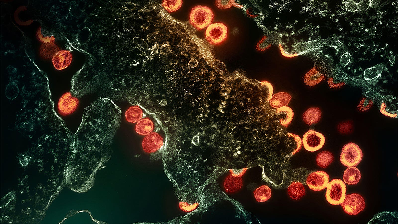 Once-weekly oral combo for HIV maintains high rates of virologic ...