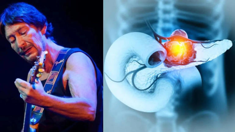 Chris Rea pancreatic cancer: Early warning signs of the deadly disease ...