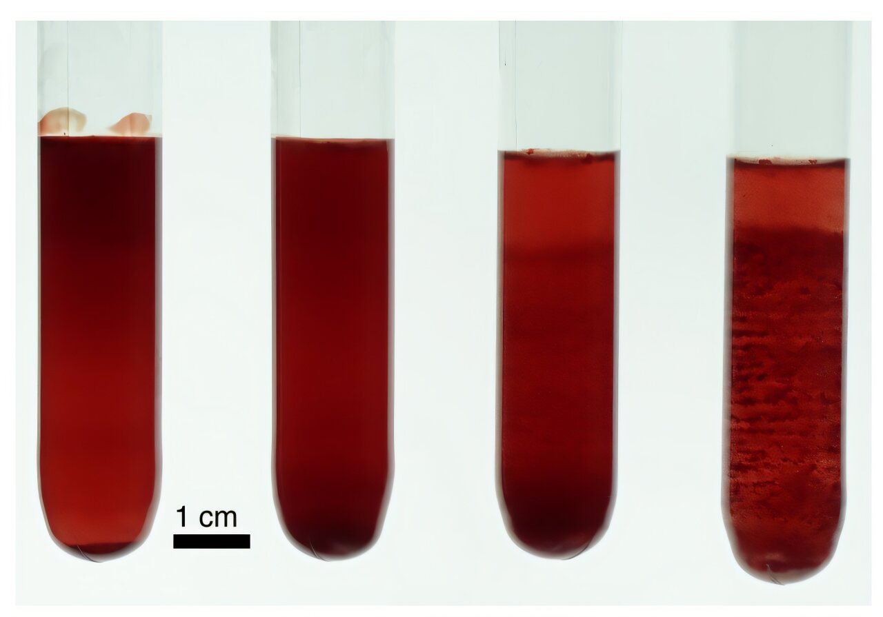 Stripe patterns in blood cells offer new clues for diagnosing disorders ...