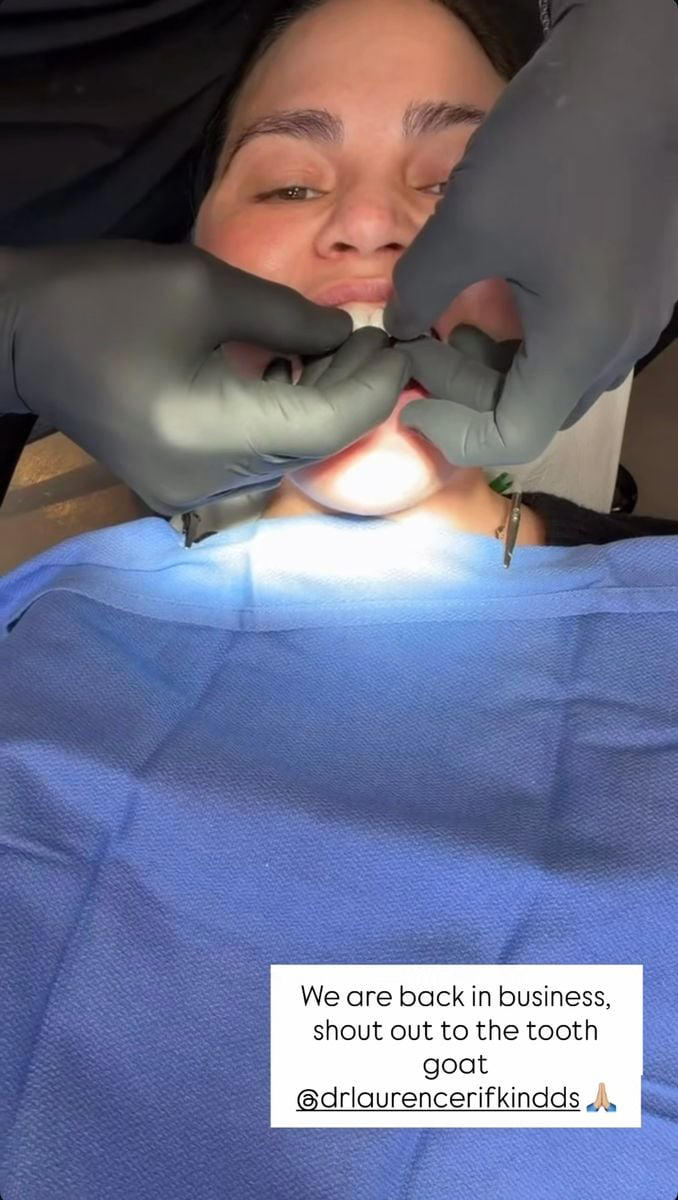 Chrissy Teigen gets her tooth put back on after candy cane project goes ...