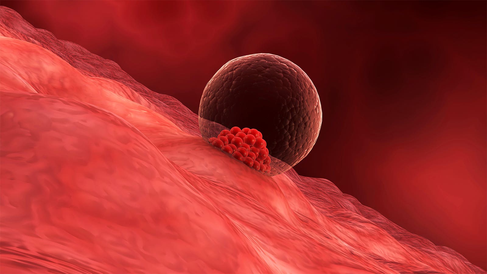 Twins joined at the heart: Single embryo transfer results in unusual case