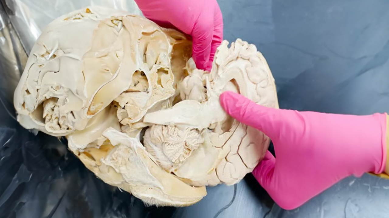 Soft helmet of the brain