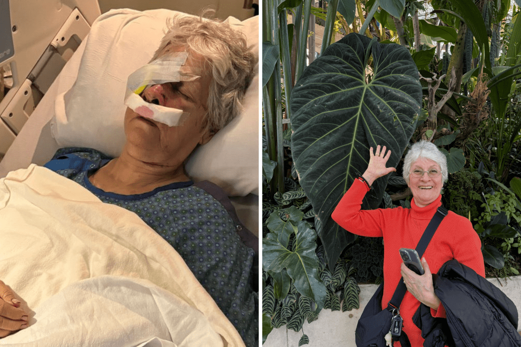 Video of brutal Seattle attack on elderly woman sparks anger