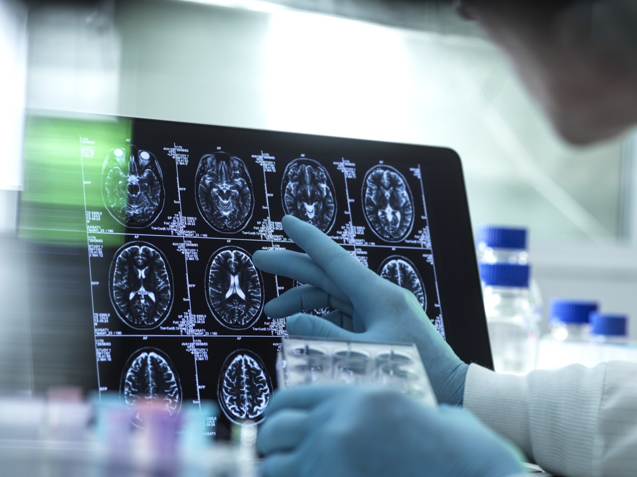 Your brain ages in five distinct stages, new research shows