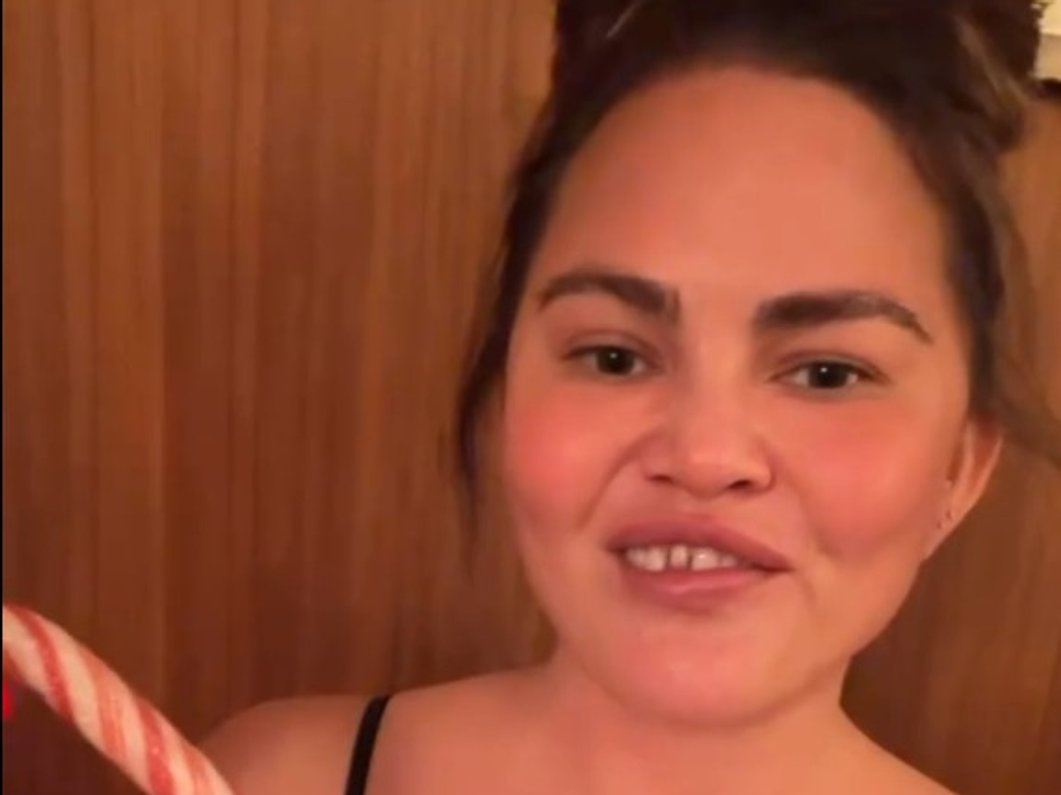 Chrissy Teigen loses a tooth during Christmas magic