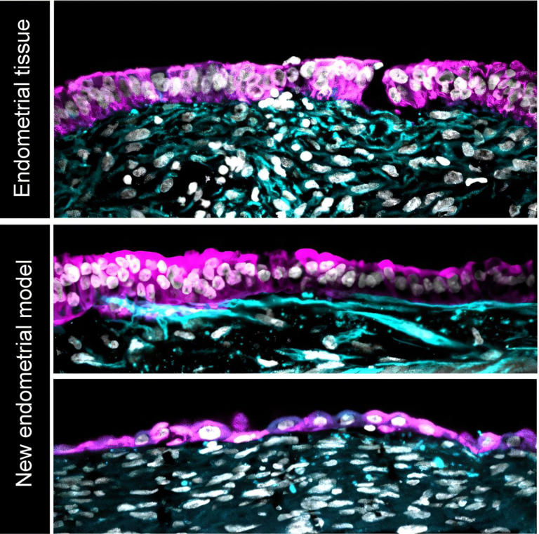 System replicates womb lining to 'listen in' to embryo-mother ...