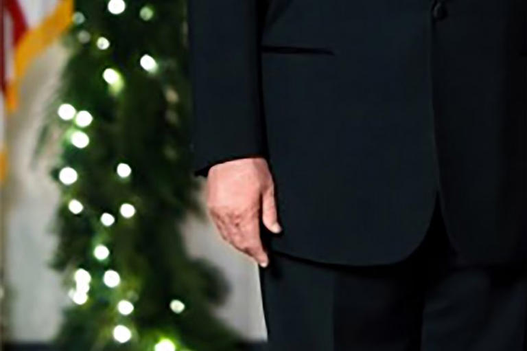 White House caught 'touching up' Donald Trump's bruise in 'embarrassing ...