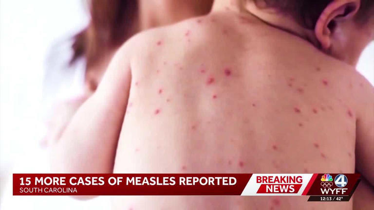 Hundreds more people likely exposed to measles as part of Upstate ...