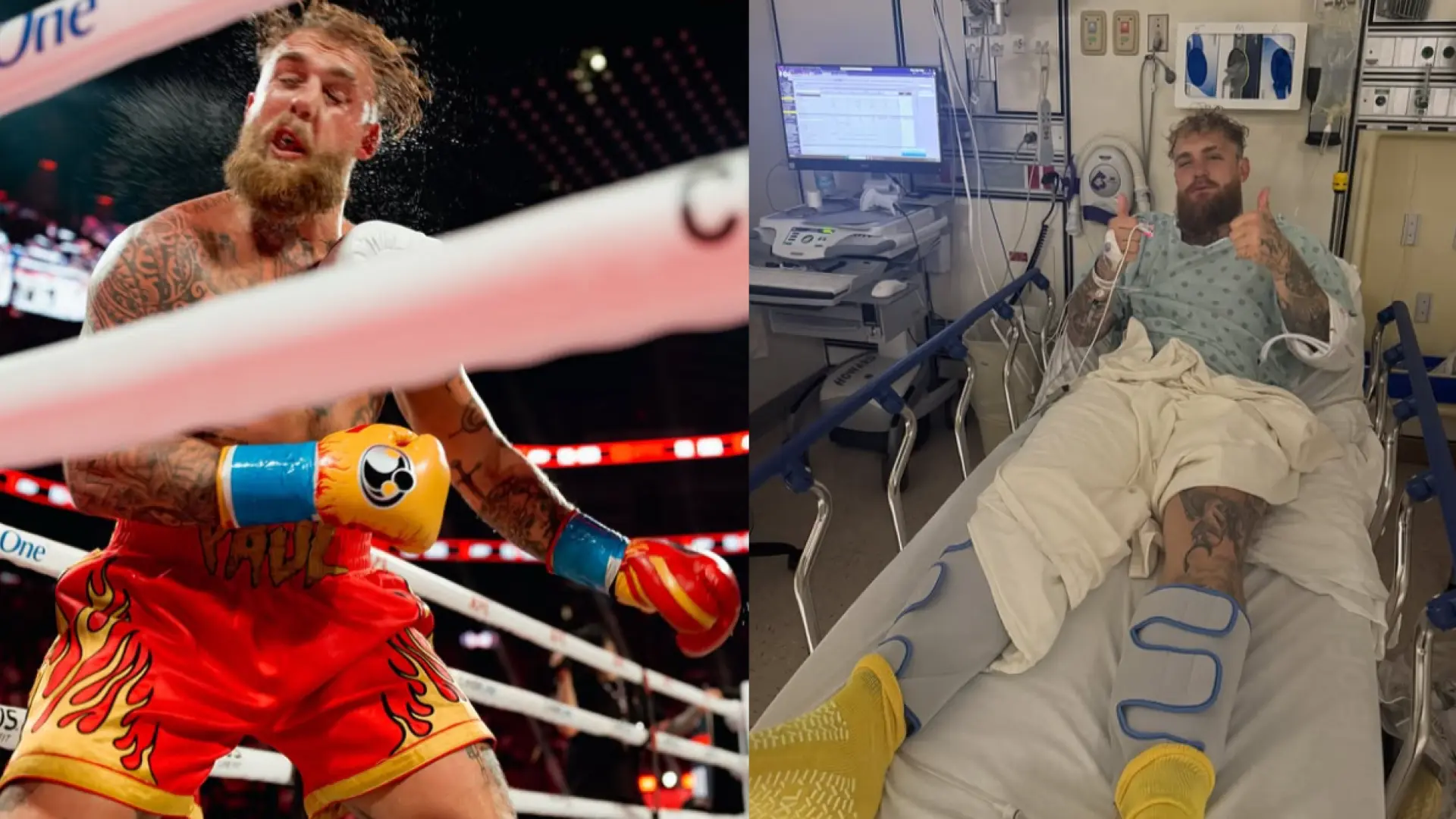 Jake Paul, operado de urgencia de una doble fractura de mandíbula ...