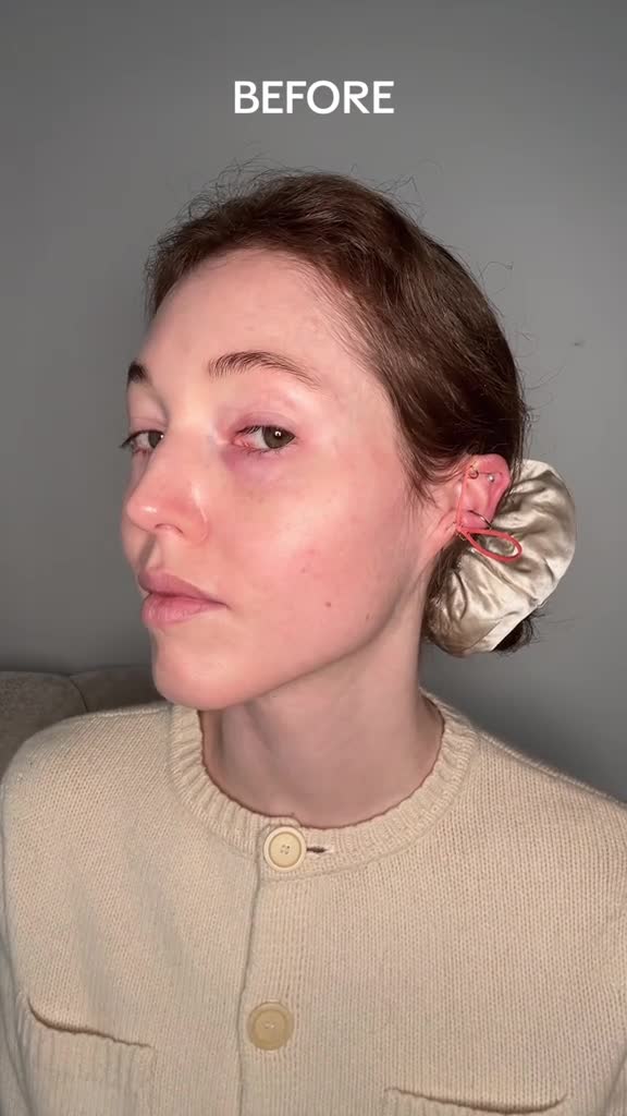 I tried the viral rubber band ear hack for lymphatic drainage