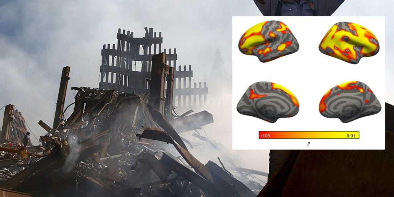Study finds brain changes in 9/11 responders with PTSD
